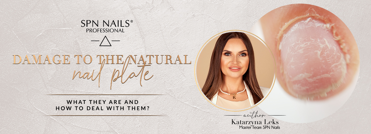 Damage to the natural nail plate - what they are and how to deal with ...